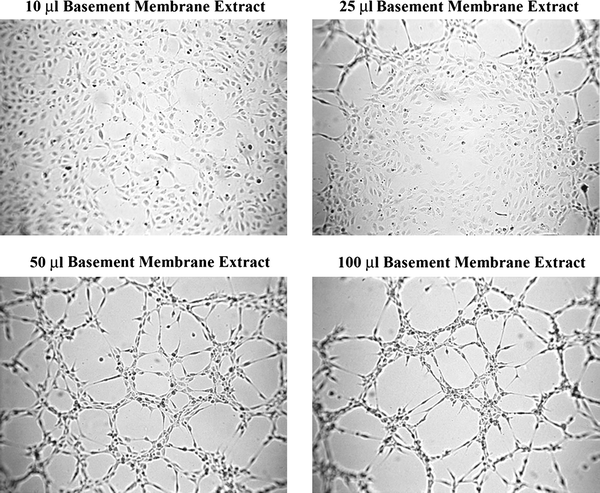 The endothelial cell tube formation assay on basement membrane turns 20 ...