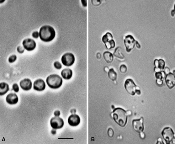 A new methanol assimilating yeast, Ogataea parapolymorpha, the ...