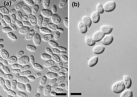 Udeniomyces kanasensis sp. nov., a ballistoconidium-forming yeast ...