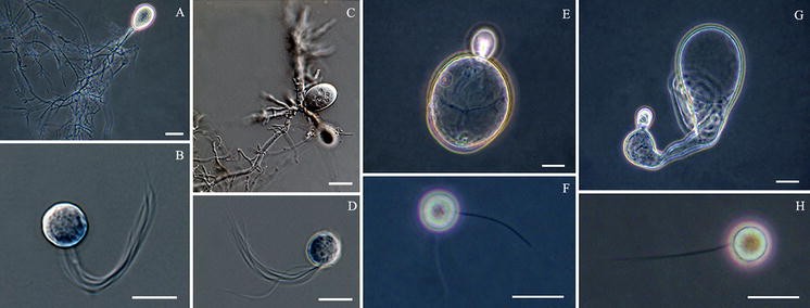Phylogeny of anaerobic fungi (phylum Neocallimastigomycota), with ...