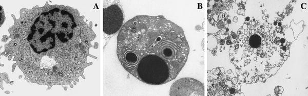 Secondary necrosis in multicellular animals: an outcome of apoptosis ...