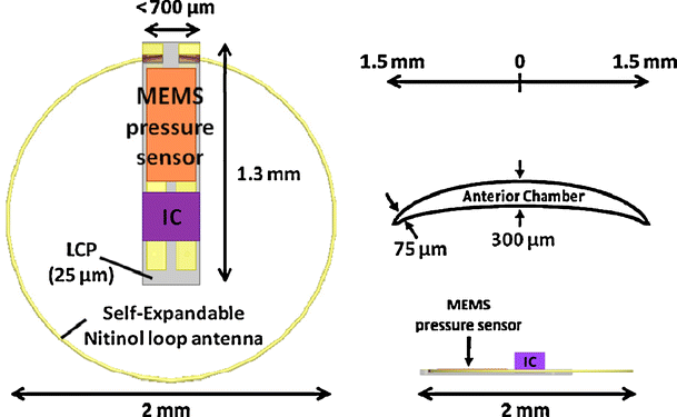Polymer-based miniature flexible capacitive pressure sensor for ...