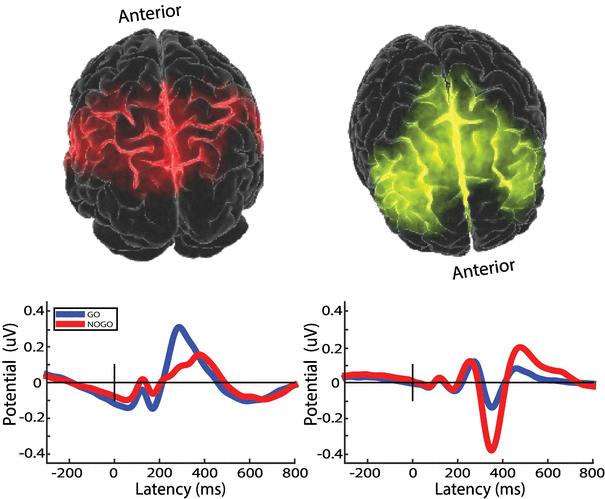 EEG Source Imaging Indices of Cognitive Control Show Associations with ...