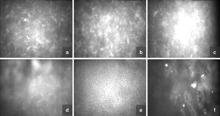 Diagnostic methods in ocular argyrosis: case report | SpringerLink