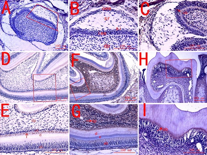 Developmental changes and regional localization of Dspp, Mepe, Mimecan ...