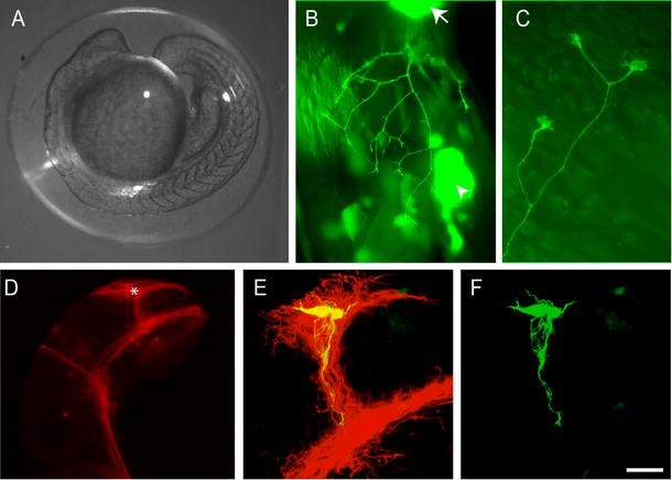HuC– eGFP mosaic labelling of neurons in zebrafish enables in vivo live ...