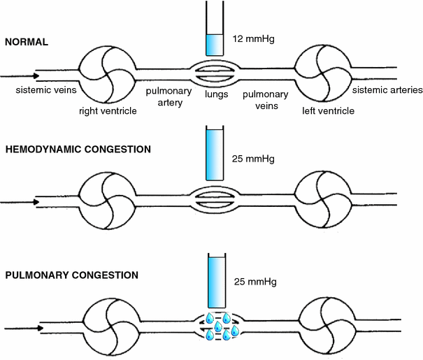 Why, when, and how to assess pulmonary congestion in heart failure ...