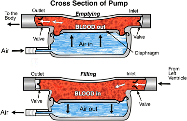 Physiologic and hematologic concerns of rotary blood pumps: what needs ...