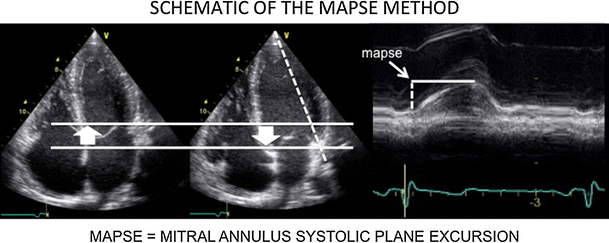 Echocardiographic assessment of left ventricular systolic function ...