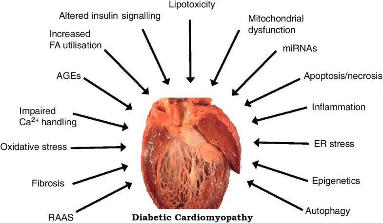 Diabetic cardiomyopathy: molecular mechanisms, detrimental effects of ...