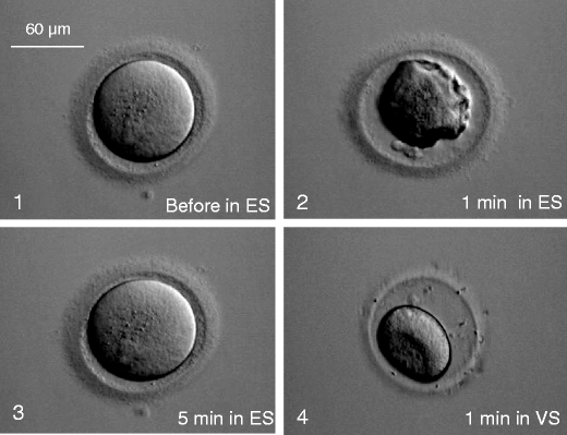Oocyte vitrification: advances, progress and future goals | SpringerLink