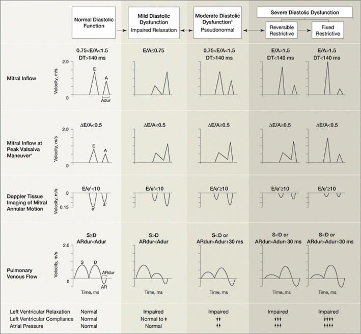 Diastolic dysfunction and atrial fibrillation | SpringerLink