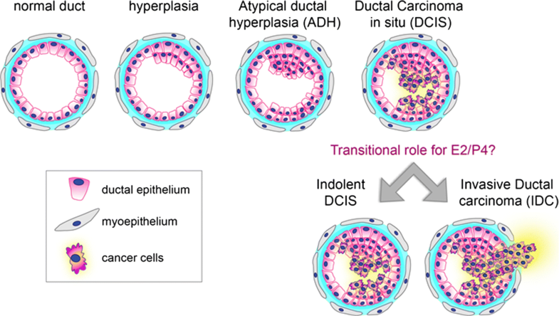 The Emerging Roles of Steroid Hormone Receptors in Ductal Carcinoma in ...