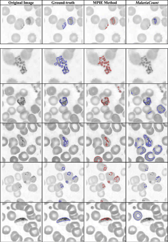 Blood Smear Image Based Malaria Parasite and Infected-Erythrocyte ...