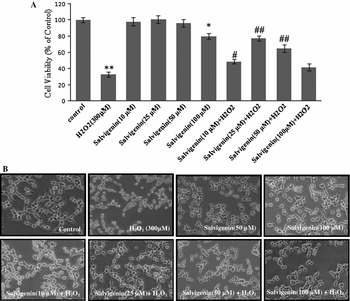 Increase of autophagy and attenuation of apoptosis by Salvigenin ...
