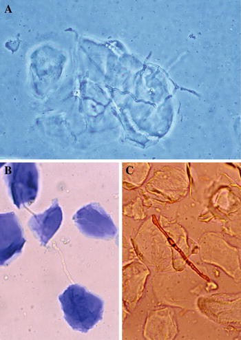 Conventional Methods for the Diagnosis of Dermatophytosis | SpringerLink