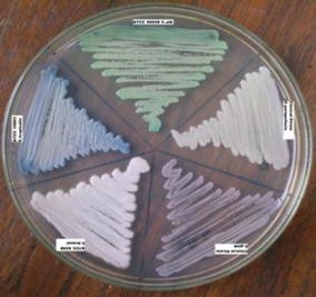 Use of CHROMagar in the Differentiation of Common Species of Candida ...