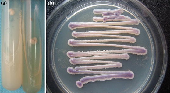 Clavispora lusitaniae and Chaetomium atrobrunneum as Rare Agents of ...