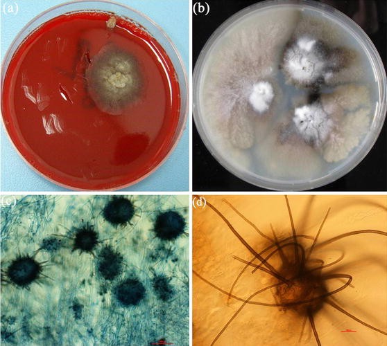 Clavispora lusitaniae and Chaetomium atrobrunneum as Rare Agents of ...