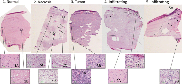 Raman molecular imaging of brain frozen tissue sections | SpringerLink