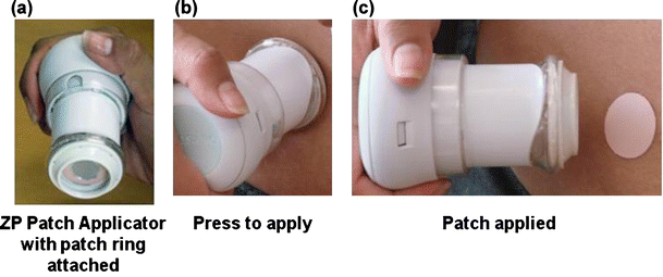 Parathyroid Hormone (1-34)-Coated Microneedle Patch System: Clinical ...