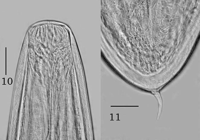 Hexamermis eurygasteri n. sp. (Nematoda: Mermithidae) parasitising the ...