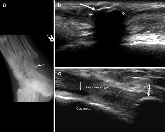 Sonographic Evaluation and Sonographic-Guided Therapeutic Options of ...