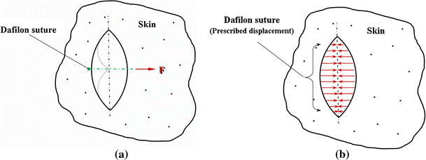 The analysis of forces needed for the suturing of elliptical skin ...