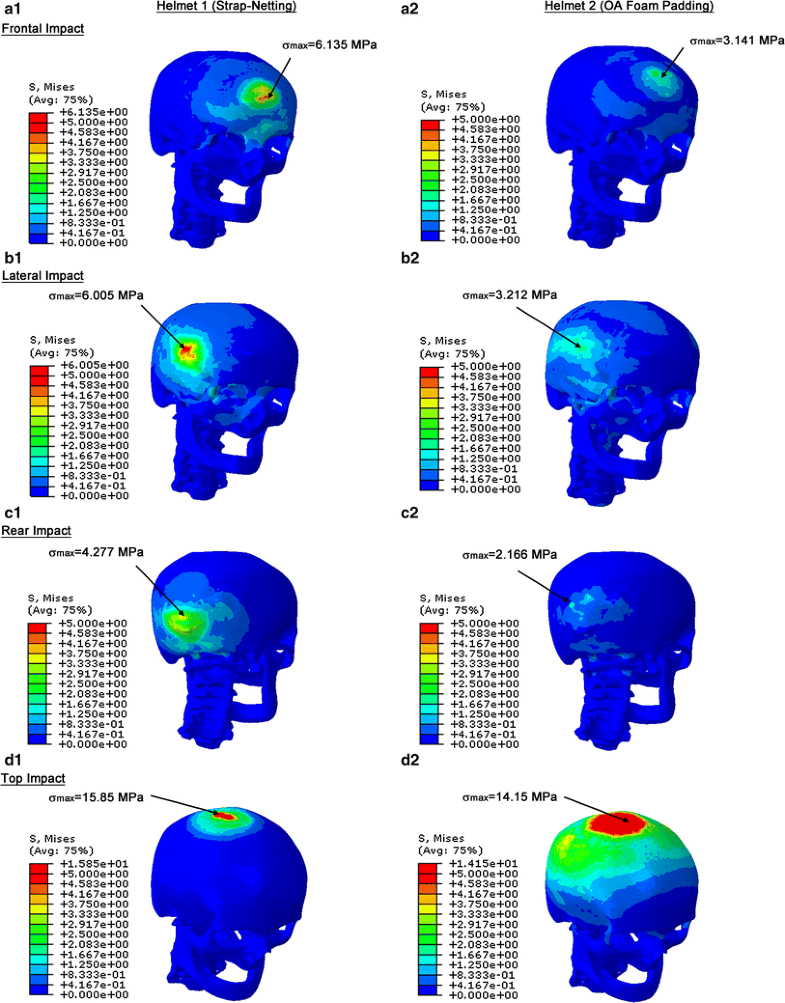 Effect of helmet liner systems and impact directions on severity of ...