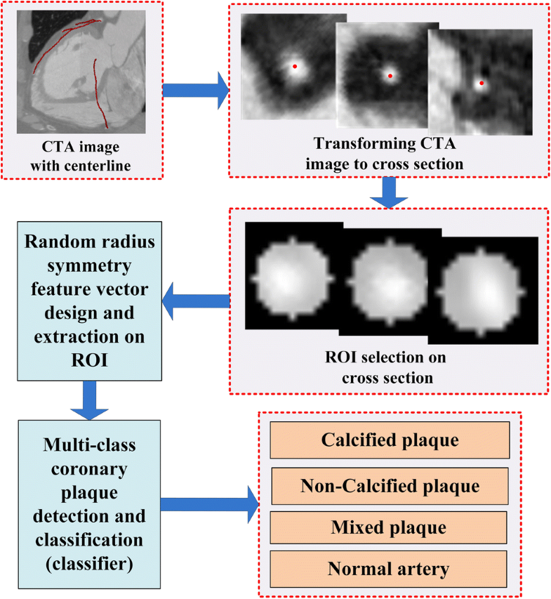An automatic multi-class coronary atherosclerosis plaque detection and ...