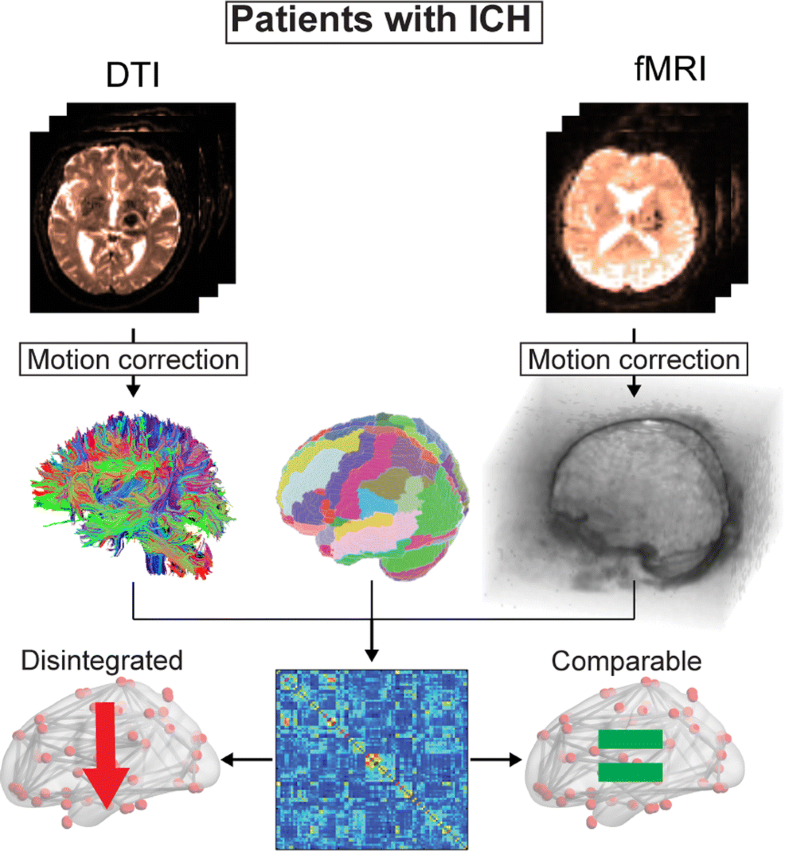 Multimodal neuroimaging study reveals dissociable processes between ...