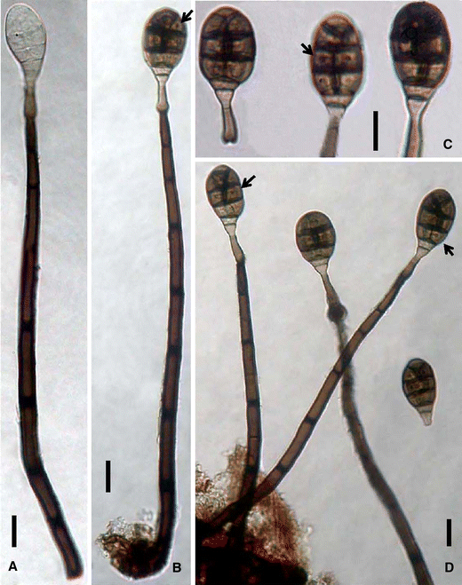 Acrodictys (Hyphomycetes) and related genera from China | SpringerLink