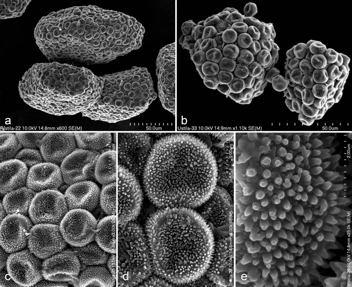 A molecular phylogenetic framework for Anthracocystis (Ustilaginales ...