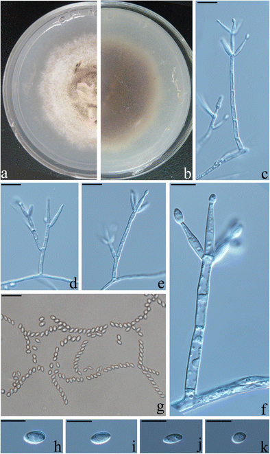 Phylogenetic assessment and taxonomic revision of Mariannaea | SpringerLink