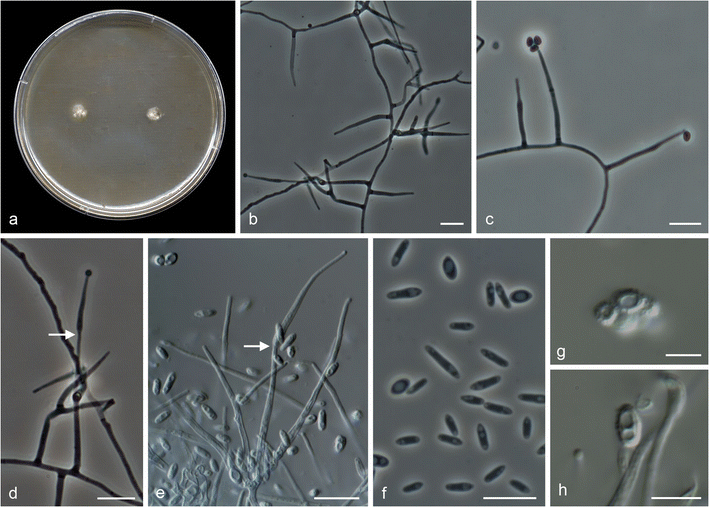 New acremonium-like species in the Bionectriaceae and ...