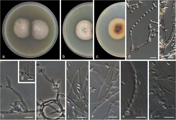 New acremonium-like species in the Bionectriaceae and ...