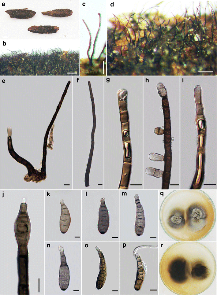 Molecular taxonomy of five species of microfungi on Alnus spp. from ...