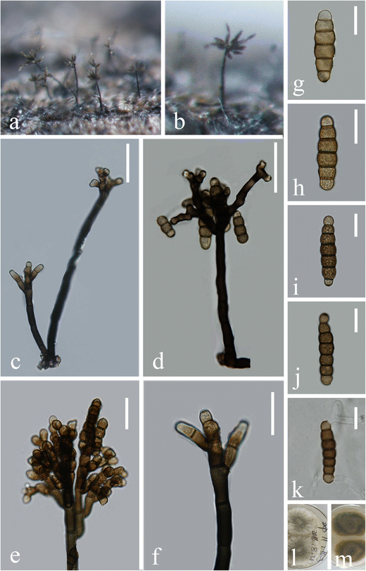 Morphology and multigene phylogeny reveal new genus and species of Torulaceae from freshwater ...