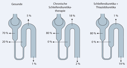 Diuretika – tubuläre Wirkmechanismen und nephrologische Indikationen ...