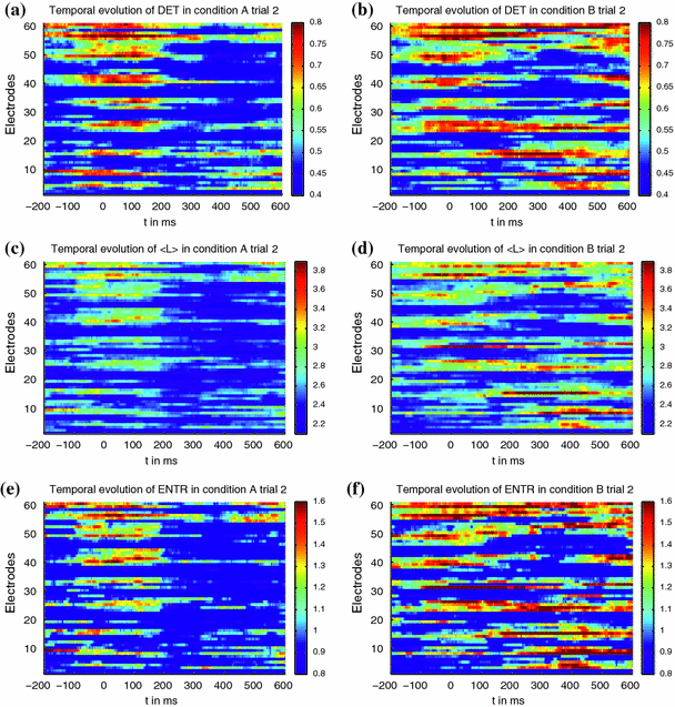 Order patterns recurrence plots in the analysis of ERP data | SpringerLink