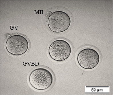 The beneficial effect of repaglinide on in vitro maturation and ...