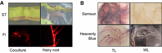 Co-expression of basic helix–loop–helix protein (bHLH) and ...
