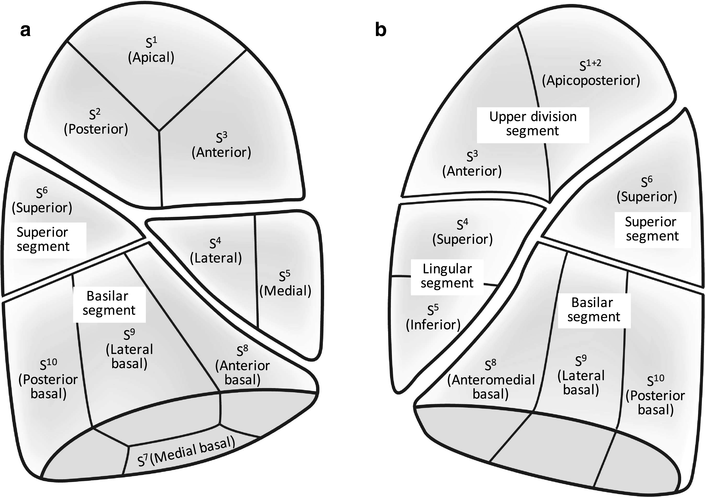 VATS segmentectomy: past, present, and future | SpringerLink