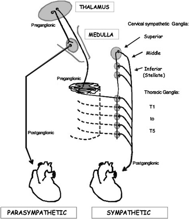 Endoscopic thoracic sympathectomy for long QT syndrome | SpringerLink