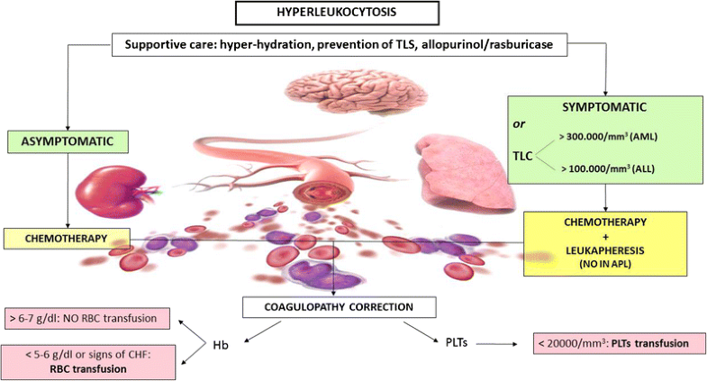 Management of Hyperleukocytosis | SpringerLink
