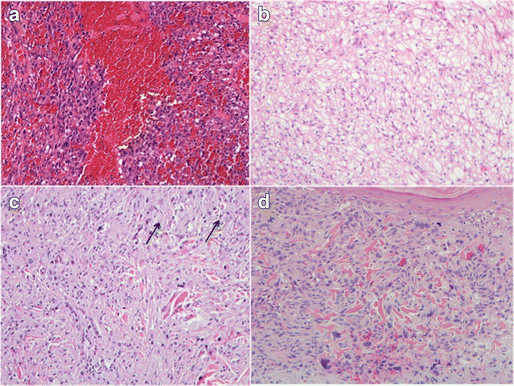 Conception and Management of a Poorly Understood Spectrum of ...