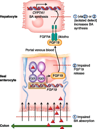 Mechanisms of Diarrhea | SpringerLink