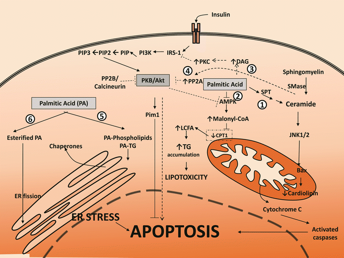 Cardiac Lipotoxicity: Molecular Pathways and Therapeutic Implications ...
