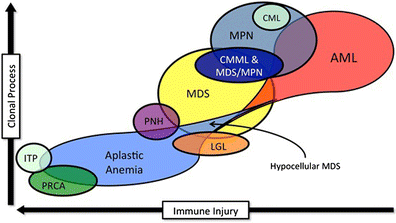 I Walk the Other Line: Myelodysplastic/Myeloproliferative Neoplasm ...