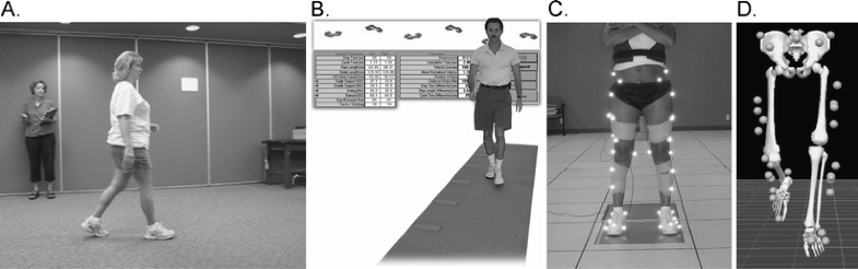 Gait Abnormalities in Multiple Sclerosis: Pathogenesis, Evaluation, and ...